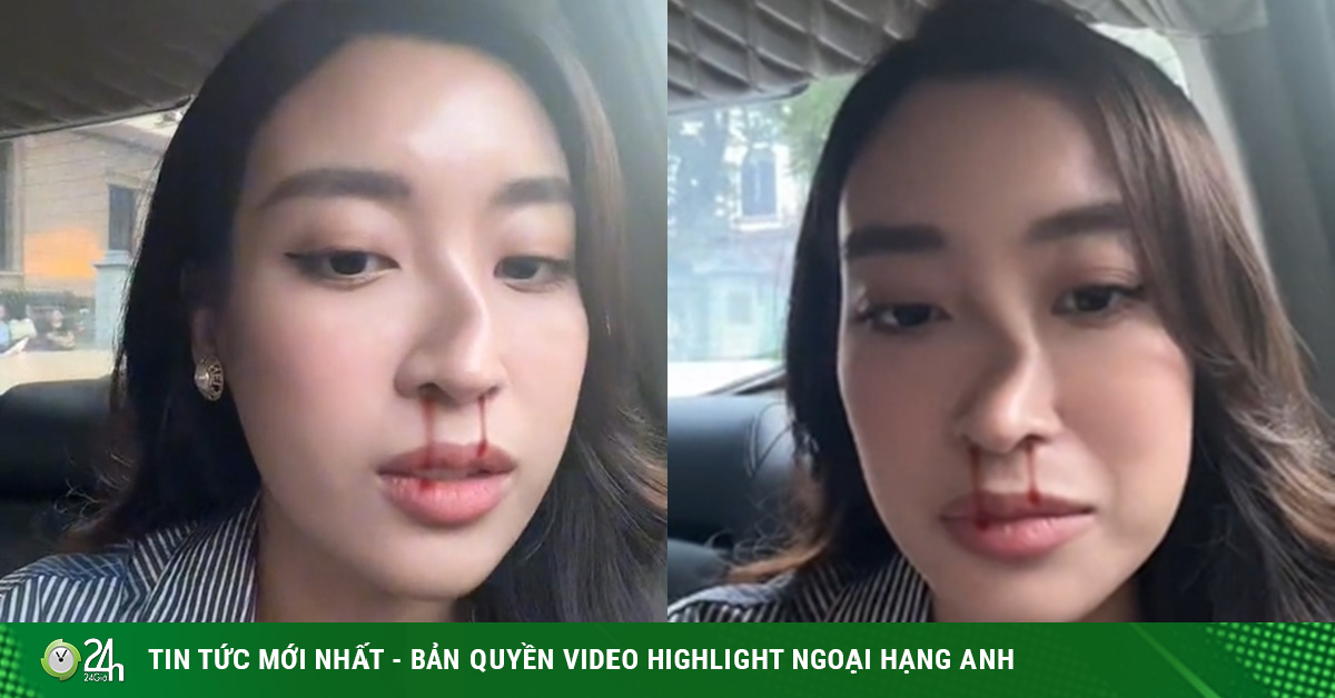 Đỗ Mỹ Linh đăng clip bị "chồng đánh vẹo mũi", dân mạng liền nhắc nhở